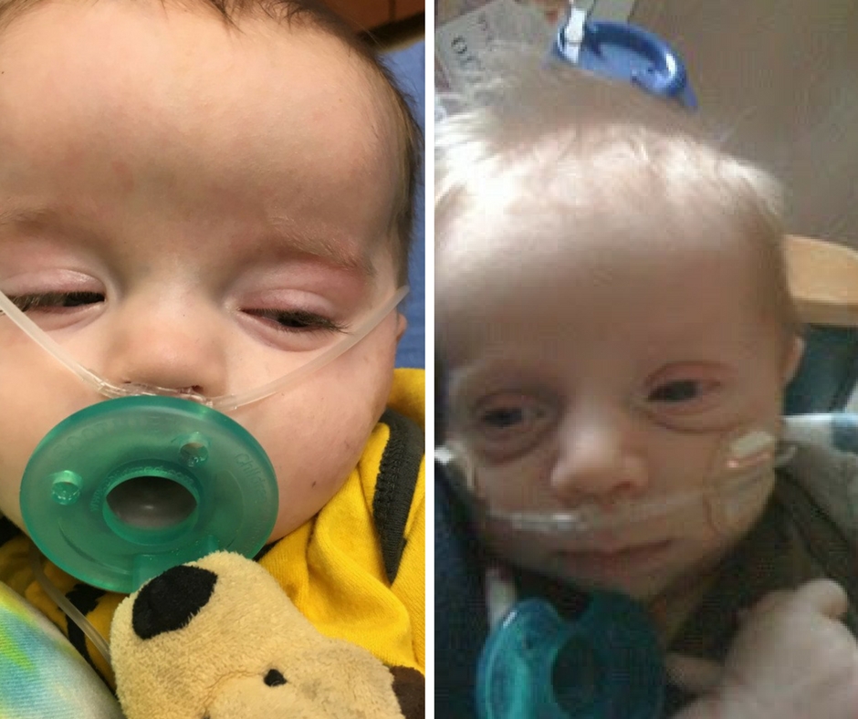 What All Parents Should Know About RSV Symptoms